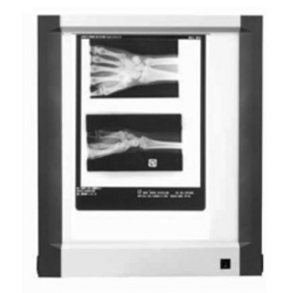 Négatoscope Ultra-Fin LED